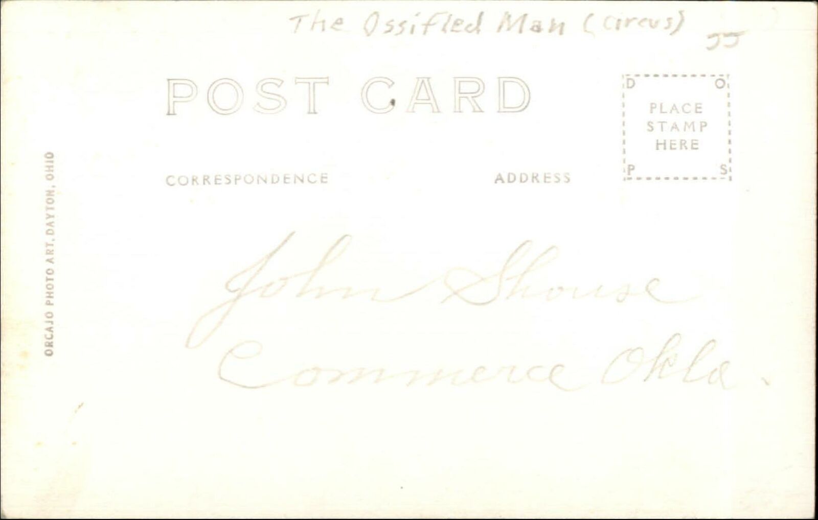 Bizarre Medical Ossified Man Nurse John Shouse Commerce OK Circus ...