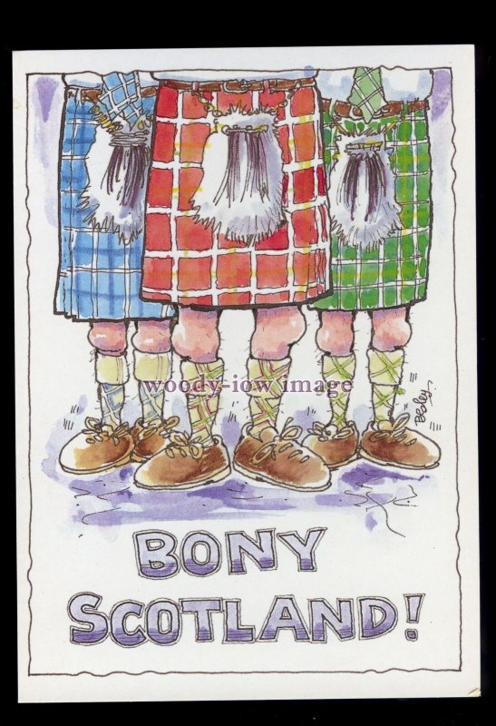 BES0026 - Bony Scotland - Knobbly Knees under Kilts - comic postcard by ...