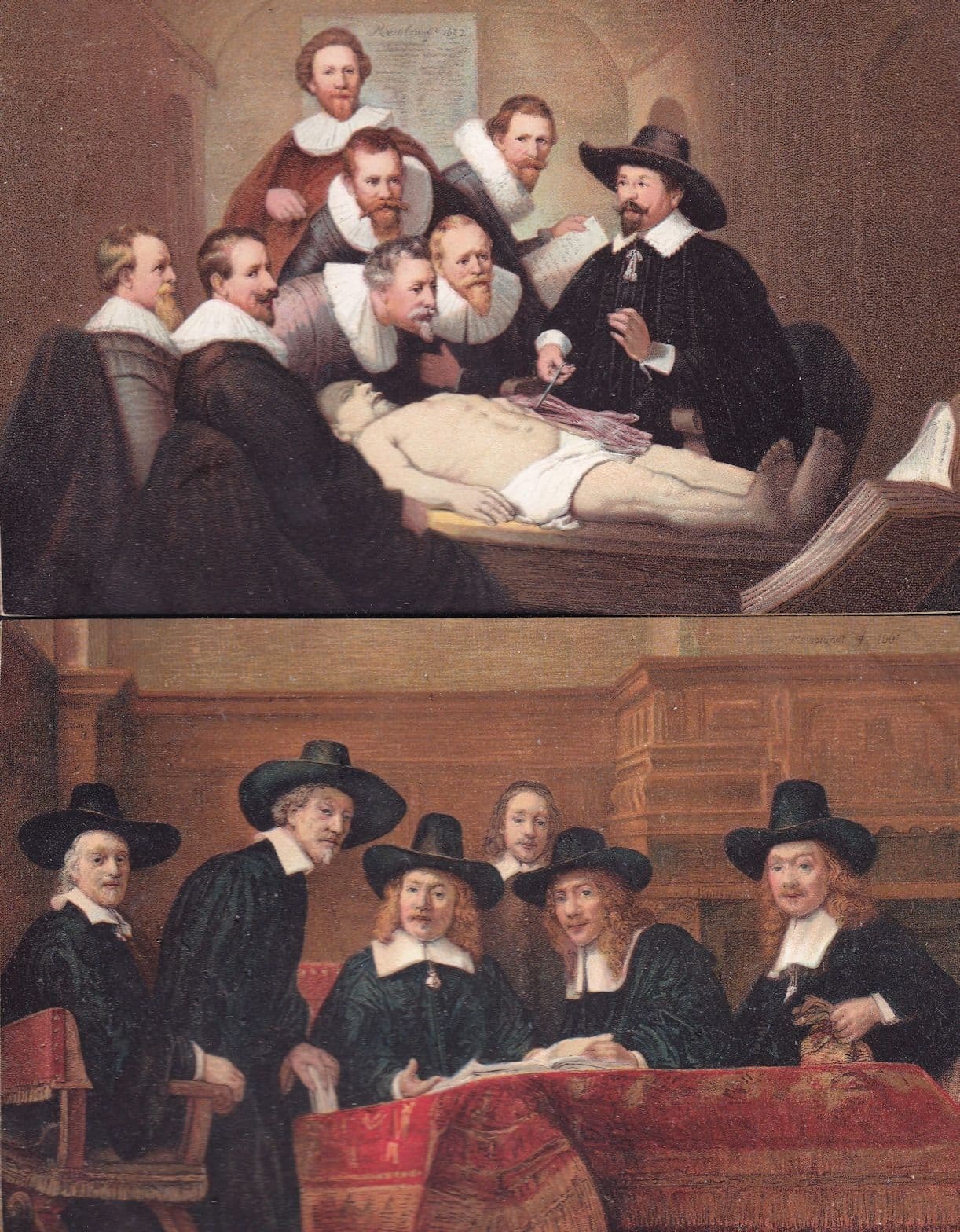 Man Doctor Operation On Intestines Rembrandt 2x Painting Postcard ...