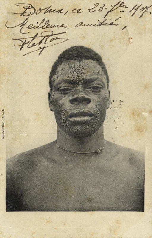 Congo Free State, Native Man Facial Tattoo Scarification (1907 ...