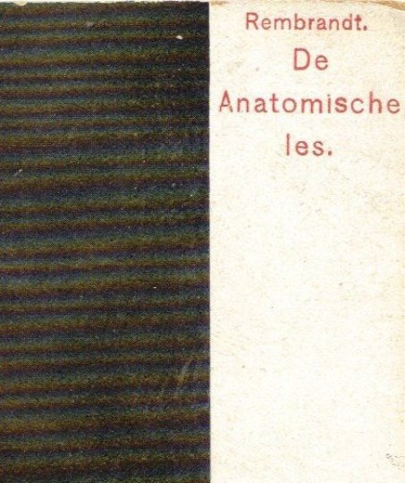 Rembrandt De Anatomische Les - Anatomy Lesson of Dr Tulp -Dutch Vintage ...