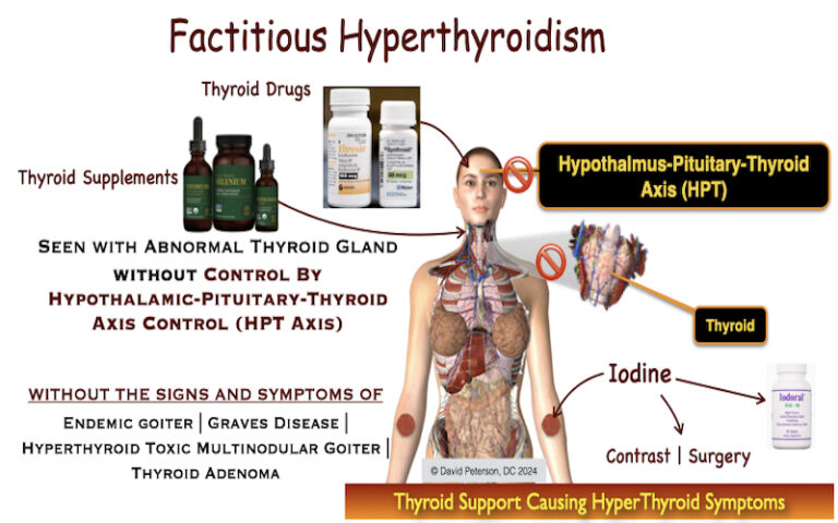 Comprehensive Guide to Factitious Hyperthyroidism - HyrSelf Functional ...