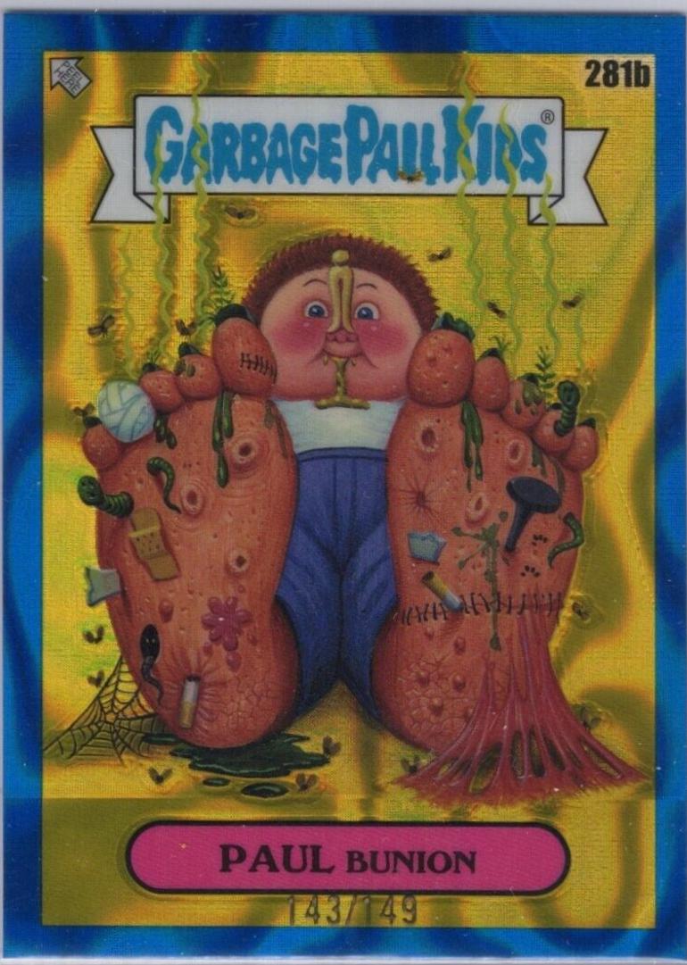 PAUL Bunion [Blue Wave Refractor] #281b Prices | 2024 Garbage Pail Kids ...