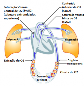 Definindo e entendendo o choque cardiogênico - Medway