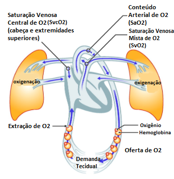 Definindo e entendendo o choque cardiogênico - Medway
