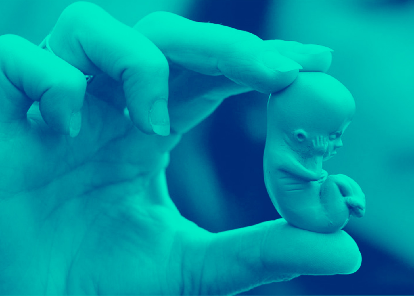 Tudo sobre curetagem uterina em casos de aborto - Medway