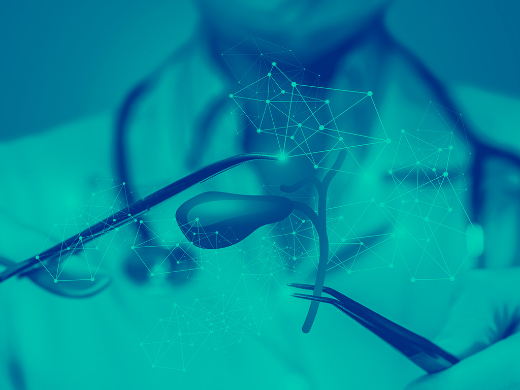 Colangite aguda: tudo que você precisa saber - Medway