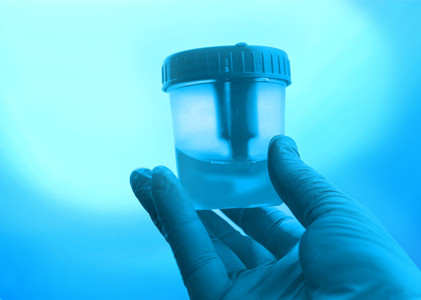 Urocultura e antibiograma: o que todo médico precisa saber - Medway Urocultura e antibiograma: o que todo médico precisa saber - Medway