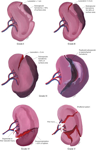 Trauma abdominal contuso: tudo que você precisa saber - Medway