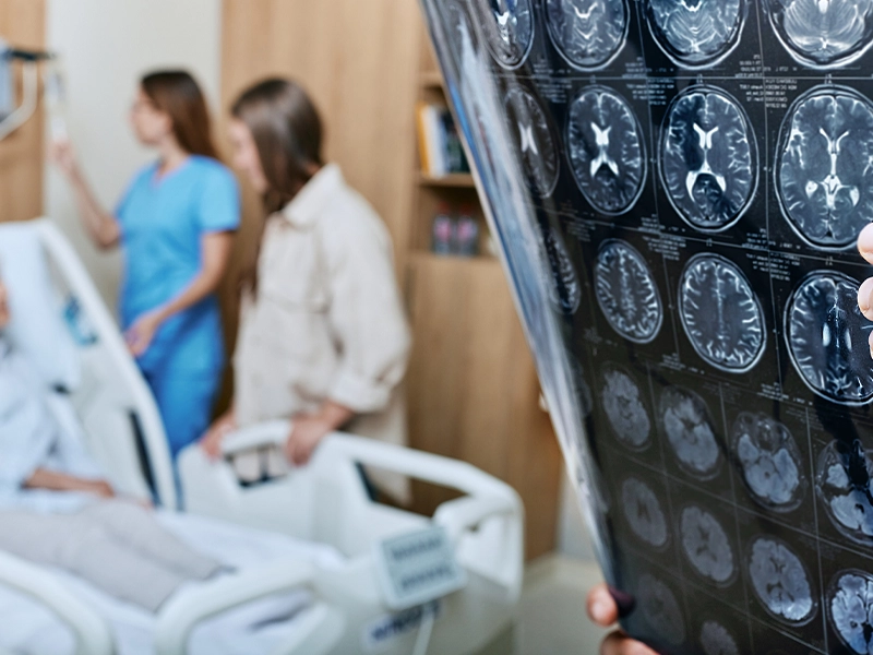 U.S. Dementia Cases are Expected to Double by 2060. Here’s How to ...