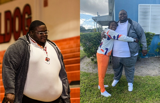 Miami Native Loses More than 250 Pounds in a Year After Bariatric ...