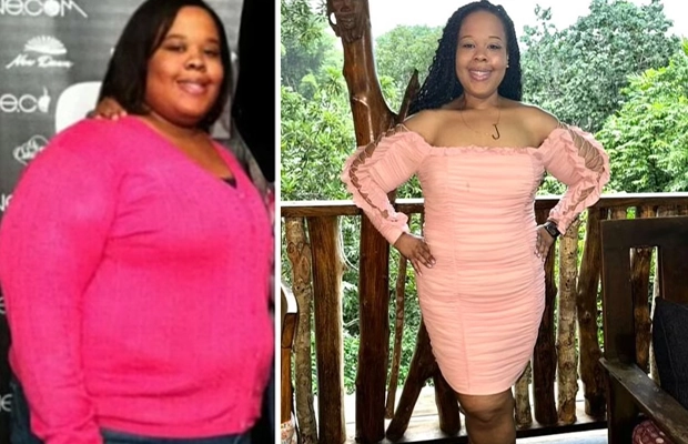 A New Beginning: How Bariatric Surgery Transformed Jessica Causey's ...
