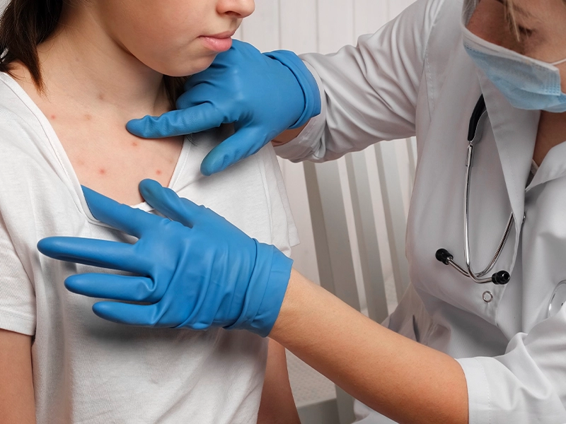 Measles Outbreak in Florida – What Parents in Miami-Dade County Should ...