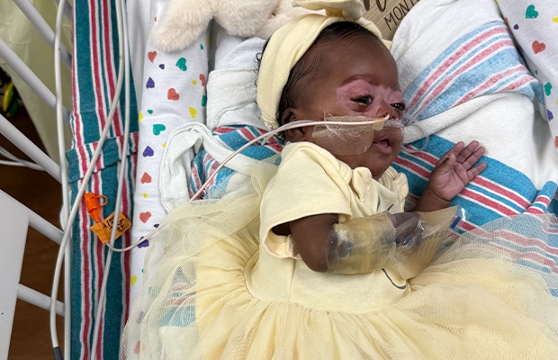 Baby Born with Complete Heart Block and Rare Fetal Condition Saved at ...