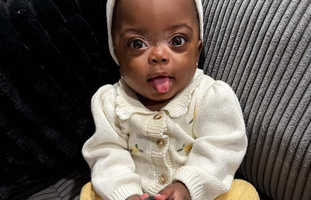 Baby Born with Complete Heart Block and Rare Fetal Condition Saved at ...