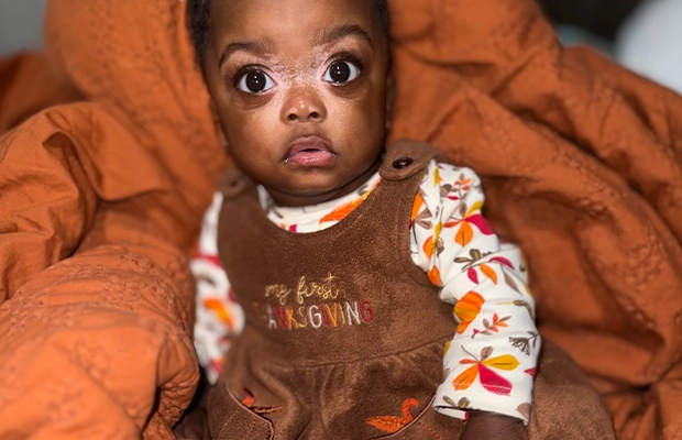 Baby Born with Complete Heart Block and Rare Fetal Condition Saved at ...