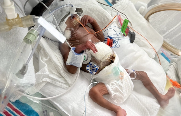 Baby Born with Complete Heart Block and Rare Fetal Condition Saved at ...