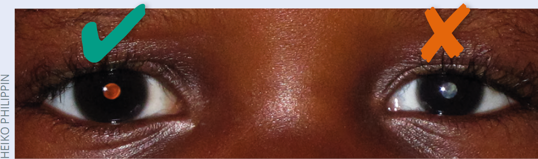 Key community eye health messages | Community Eye Health Journal