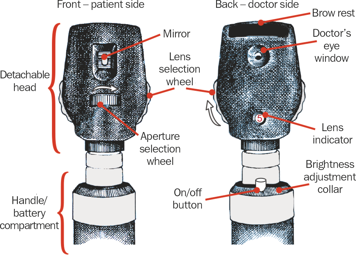 Understanding and caring for the direct ophthalmoscope | Community Eye ...