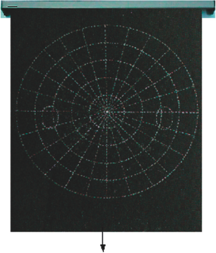 Visual field testing for glaucoma – a practical guide | Community Eye ...