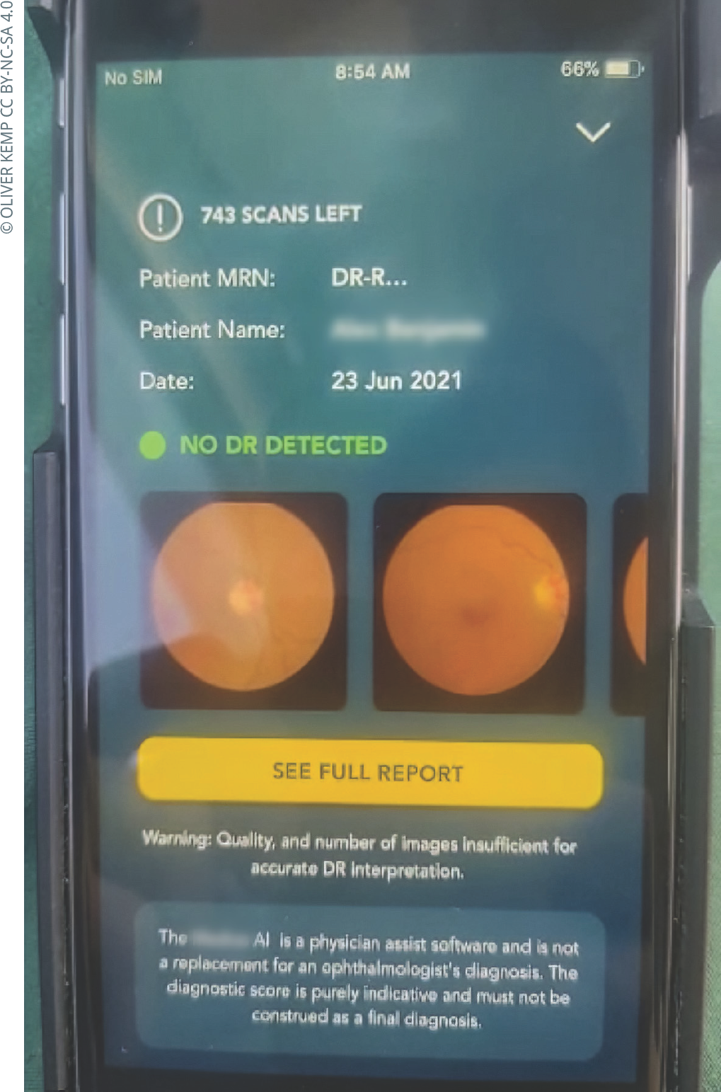 Artificial intelligence for DR screening | Community Eye Health Journal