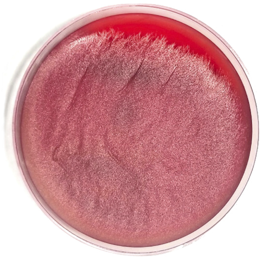 Pythium insidiosum: the organism that mimics fungal keratitis ...