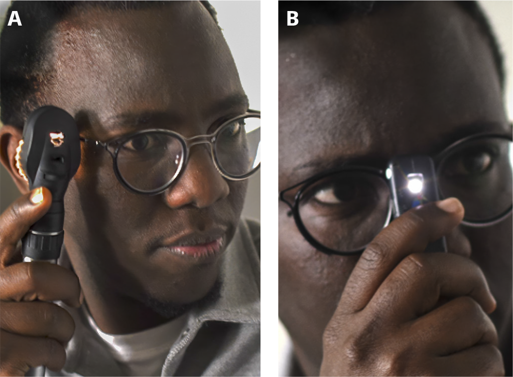 Clinical examination of the macula | Community Eye Health Journal
