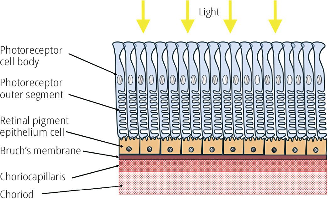 Age-related macular degeneration (AMD): an introduction | Community Eye ...