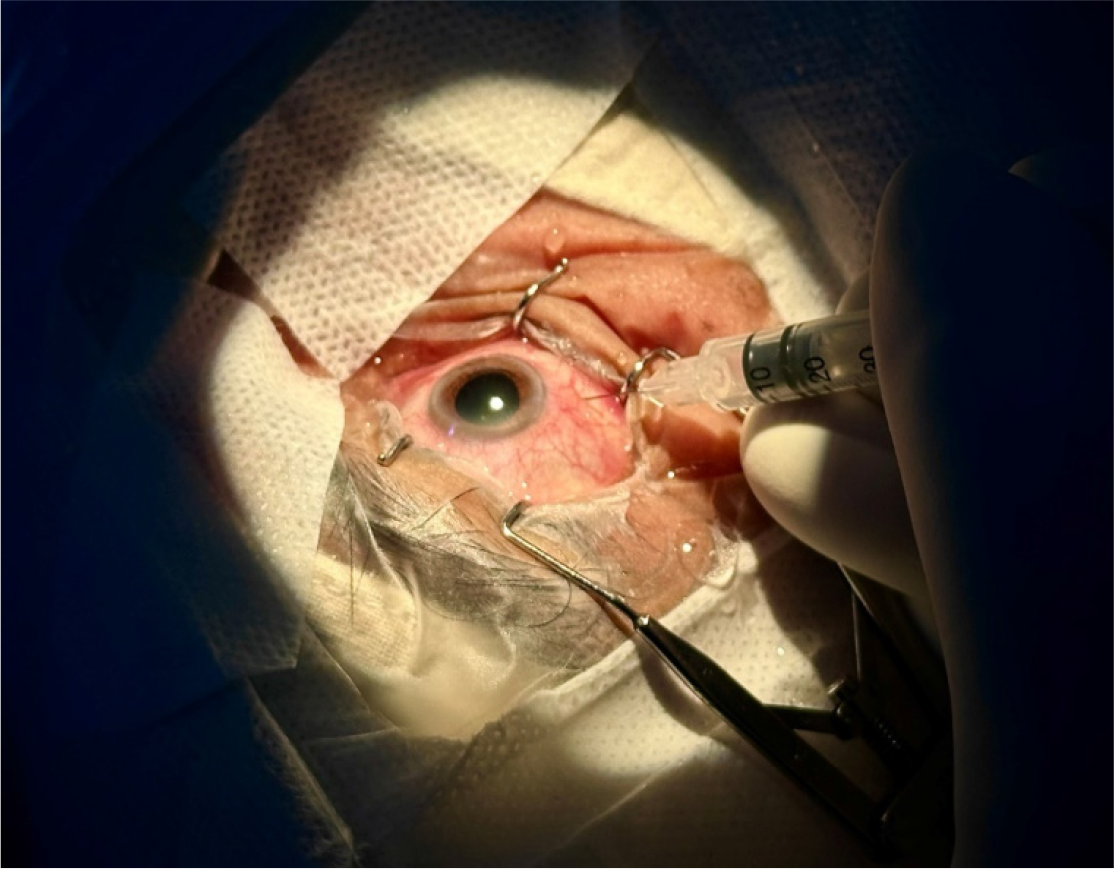 Availability and affordability of anti-VEGF biosimilars for the ...