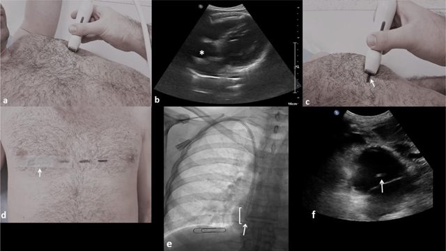 A Proposed Simple and Accurate Technique for Optimal Long-Term ...