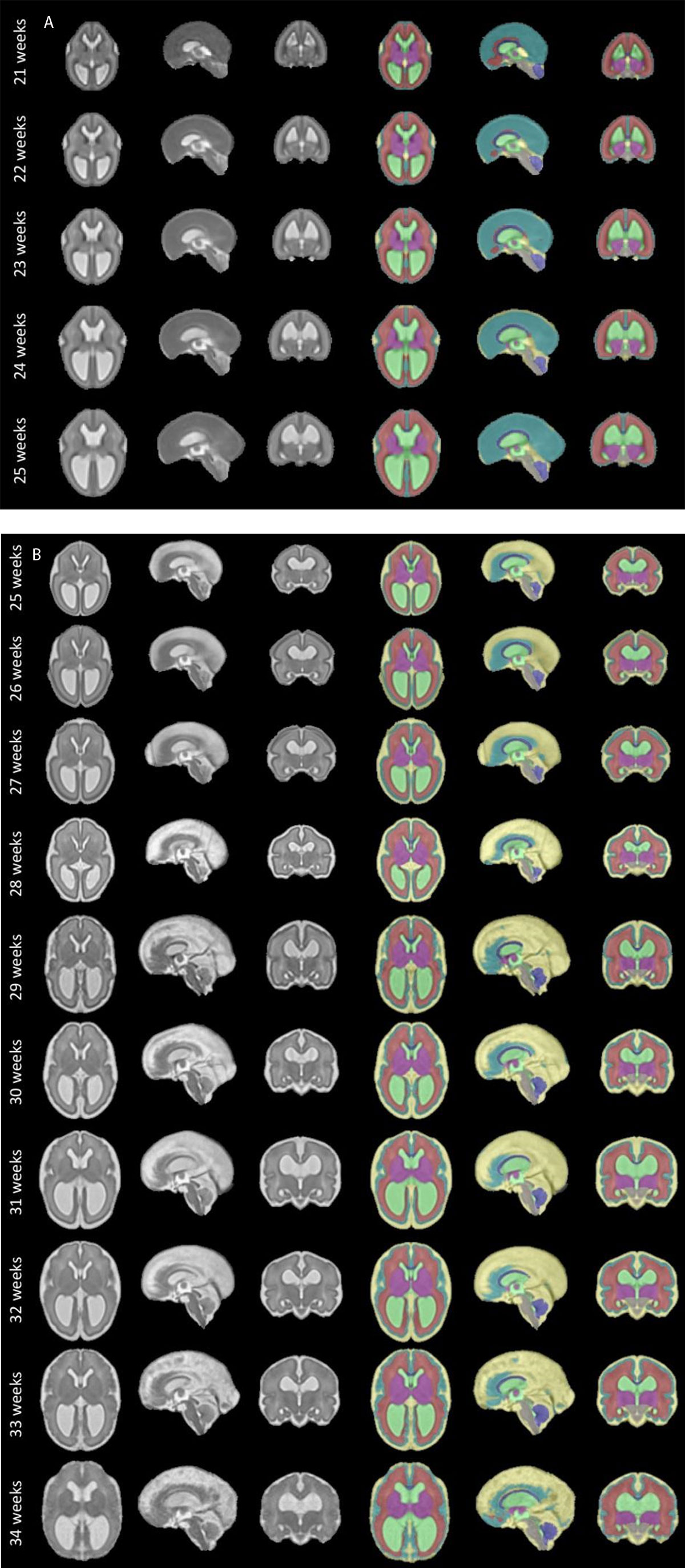 The Role of Fetal Brain Magnetic Resonance Imaging in Current Fetal Medicine | Journal of the ...