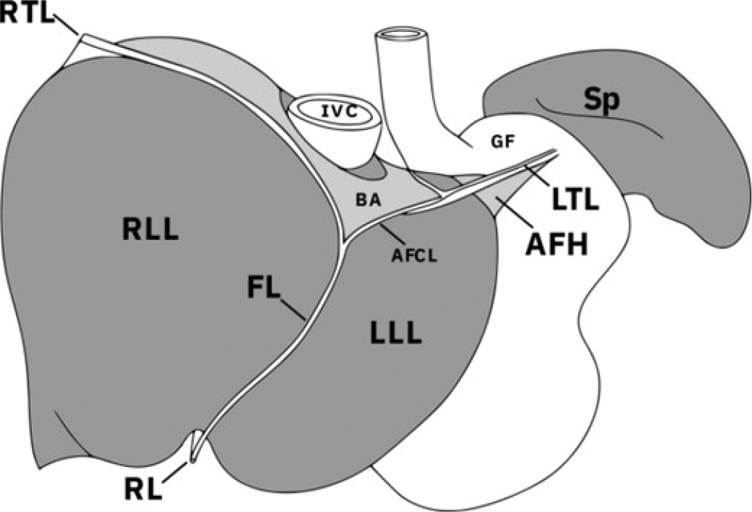 Hepatic Cysts in the Left Triangular Ligament: A Rare Finding with ...