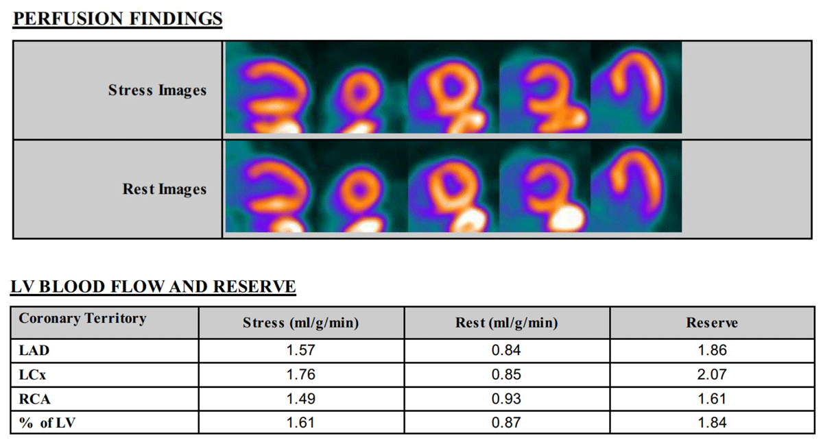Spectrum of Ischemic Heart Disease Throughout a Woman’s Life Cycle ...