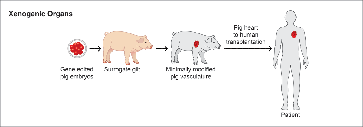 Allogeneic, Xenogeneic, and Exogenic Hearts for Transplantation ...