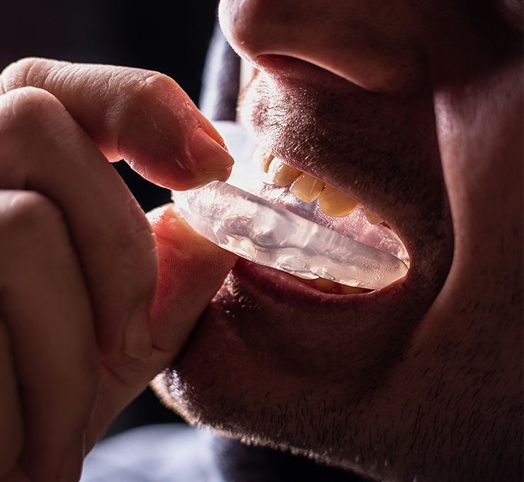Splints | My Eastwood Dentist