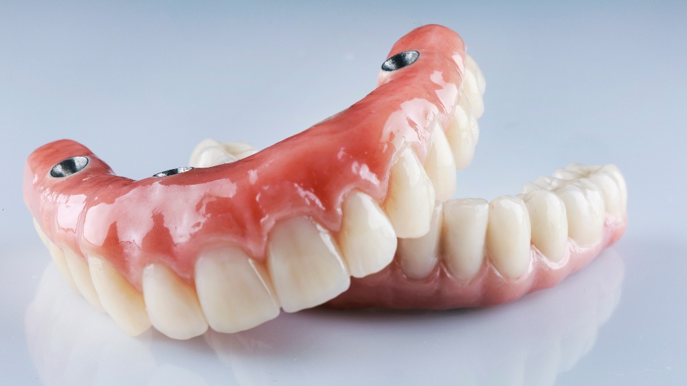 Can dentures go over teeth?