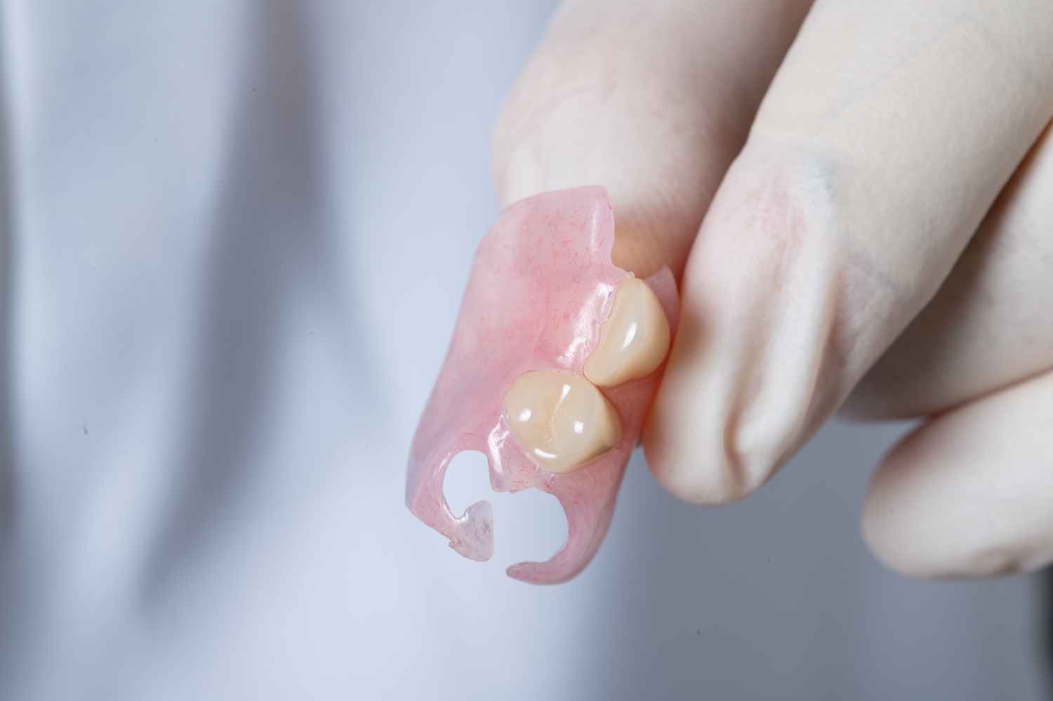 Different types of partial dentures from which to choose