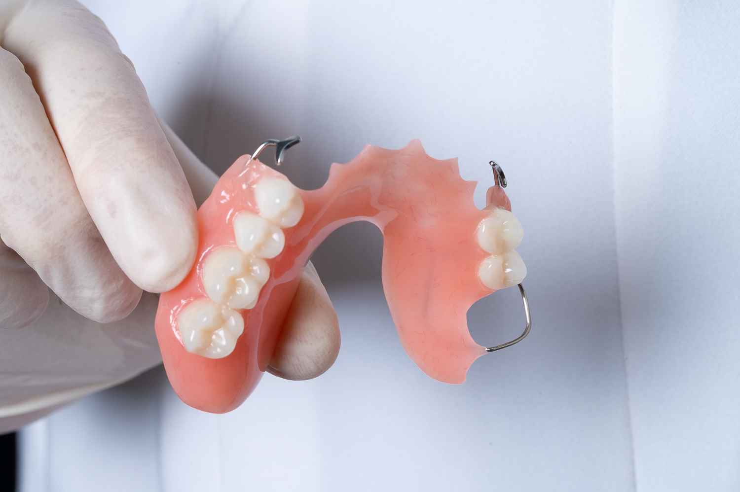 Different types of partial dentures from which to choose