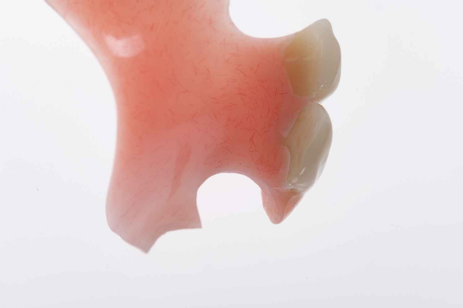 Acrylic Partial Dentures: Affordable dental solutions