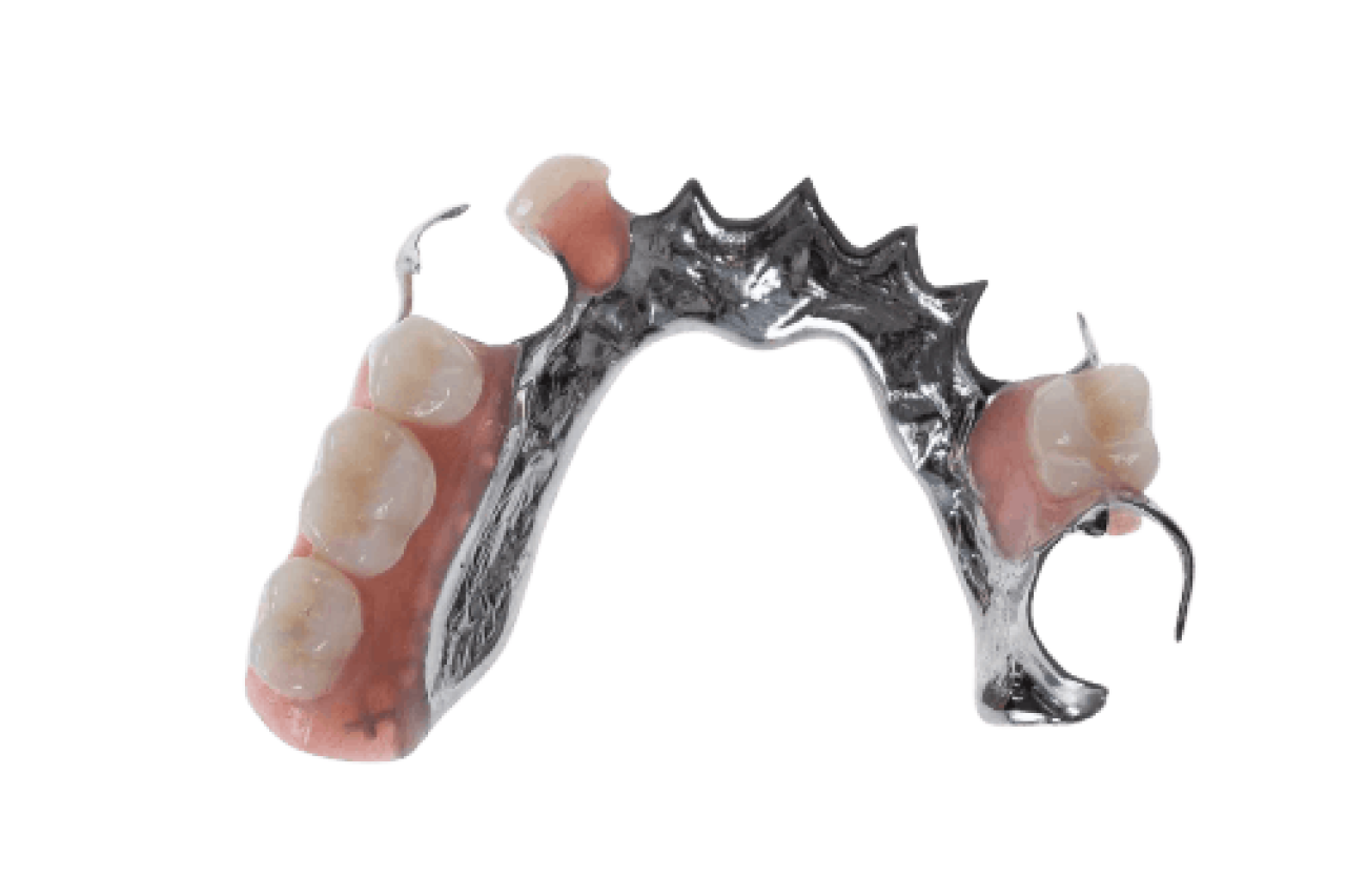 Chrome Dentures | 45+ Years Experience | Metal Partials