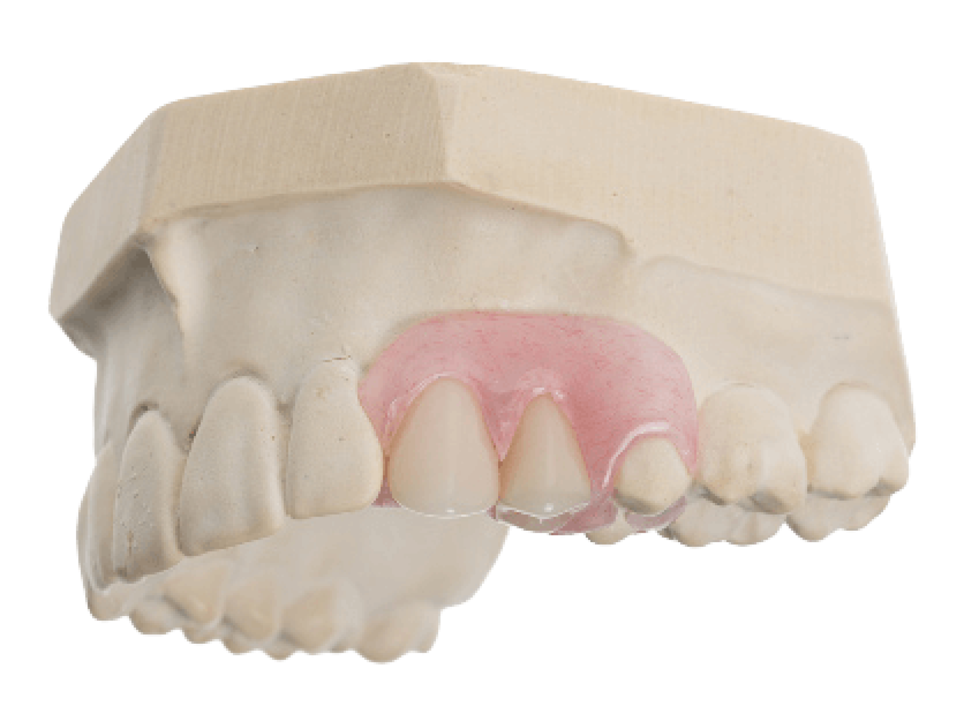 Single Tooth Denture | One tooth denture solution