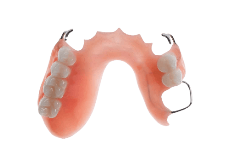 Chrome Dentures | 45+ Years Experience | Metal Partials