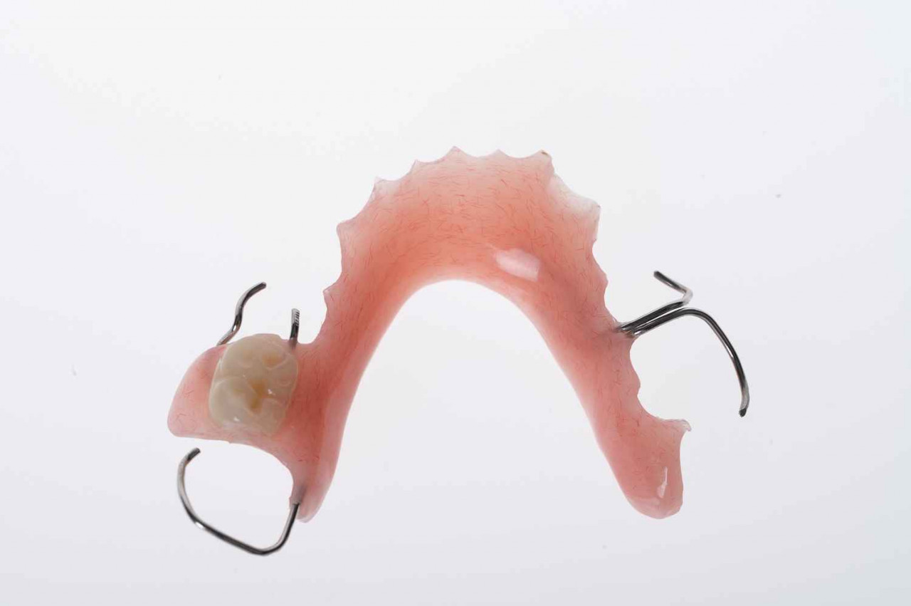 Acrylic Partial Dentures: Affordable dental solutions