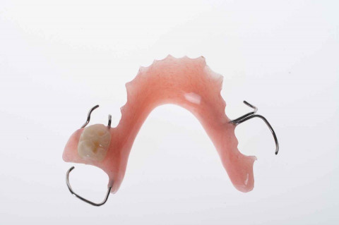Acrylic Partial Dentures: Affordable dental solutions