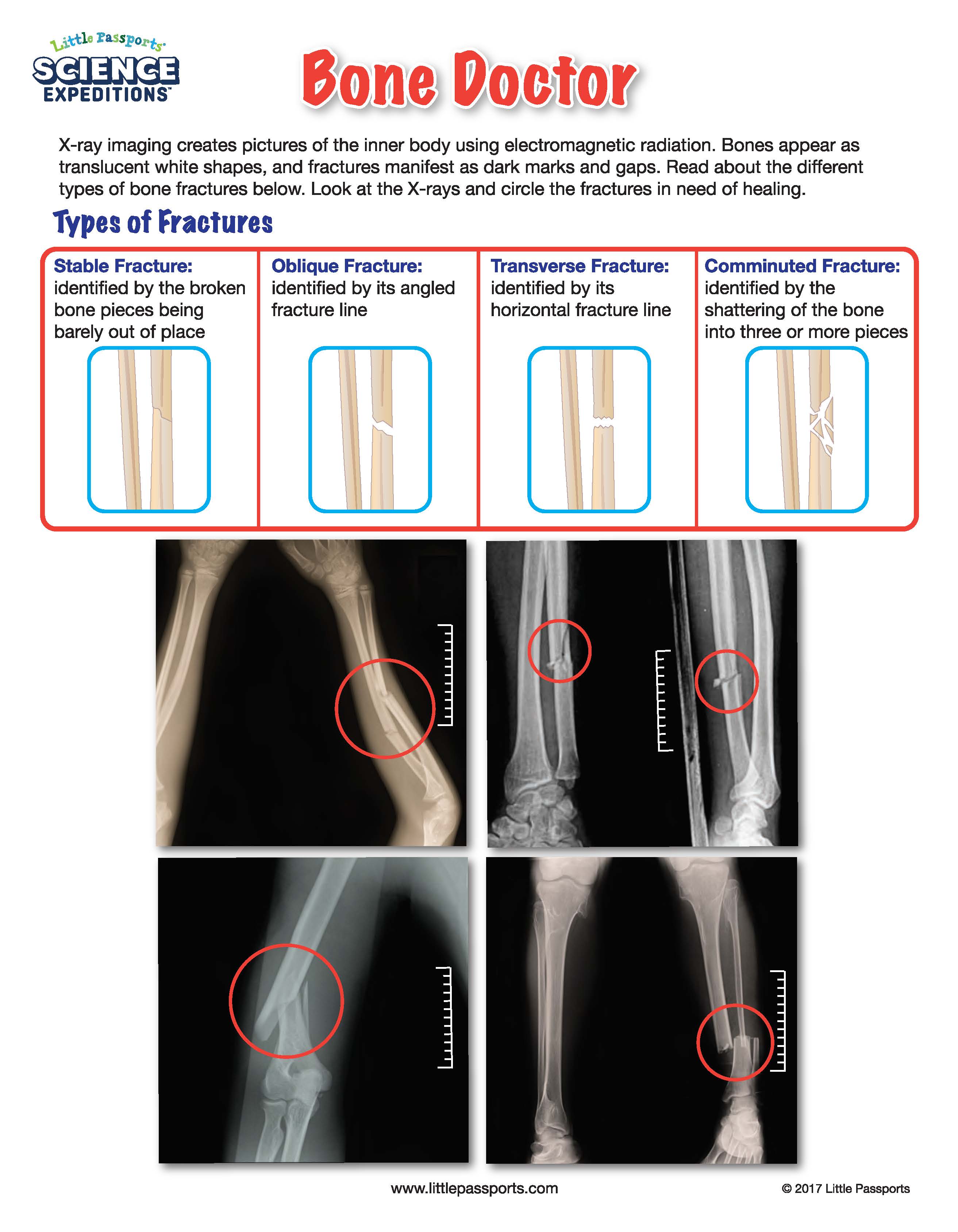 Bones - Little Passports
