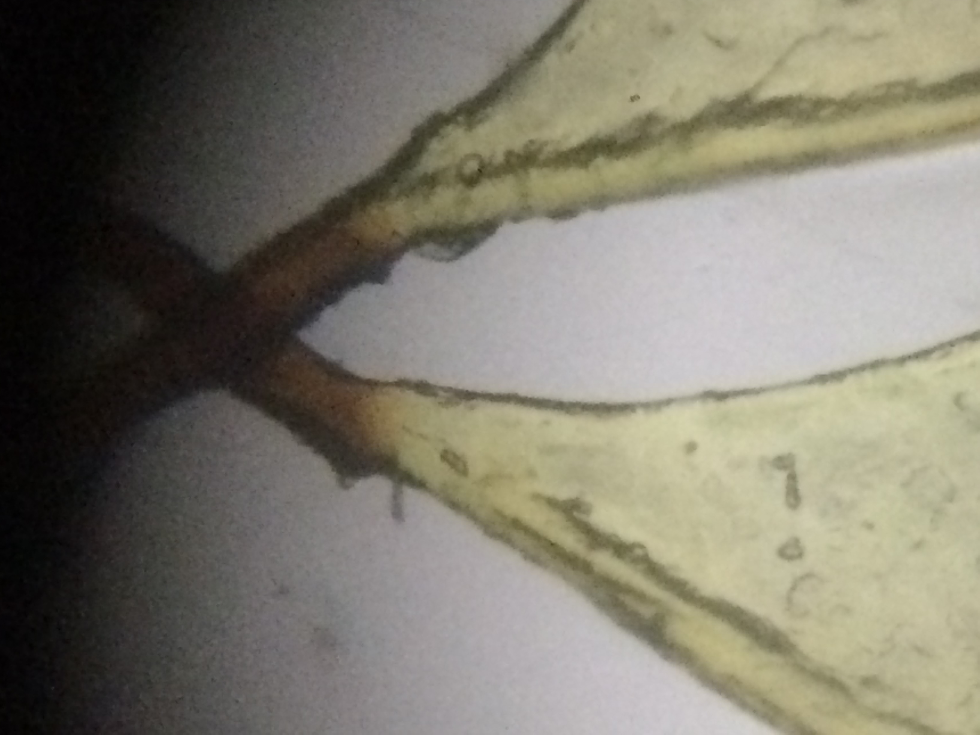 Pollinia of Calotropis under foldscope