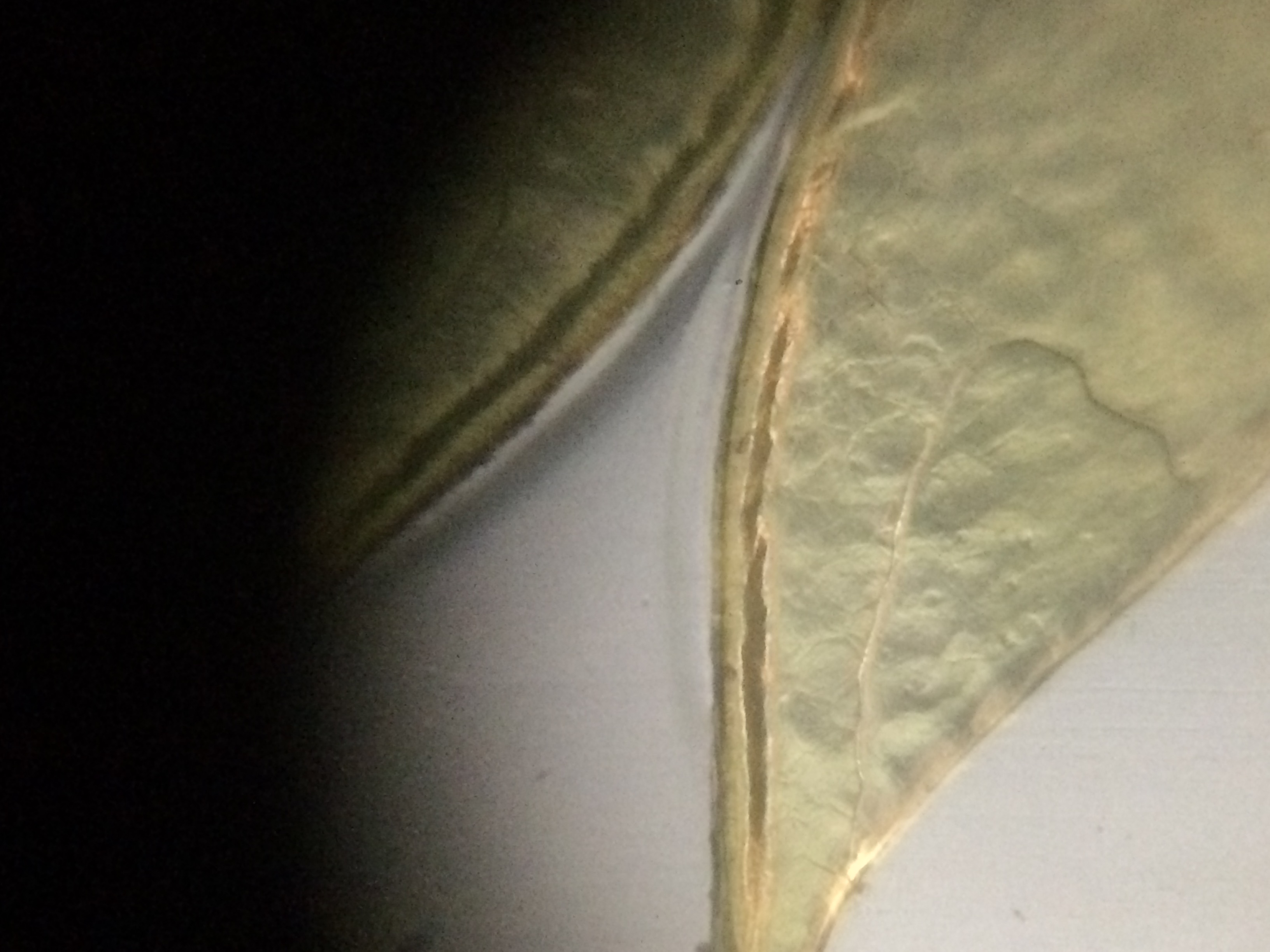 Pollinia of Calotropis under foldscope