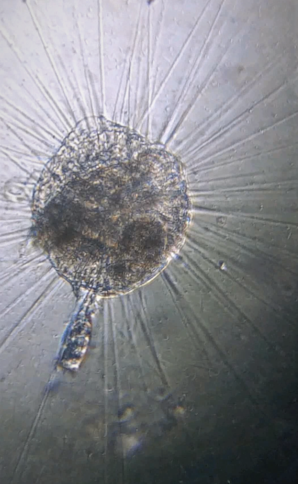 Actinosphaerium Slide