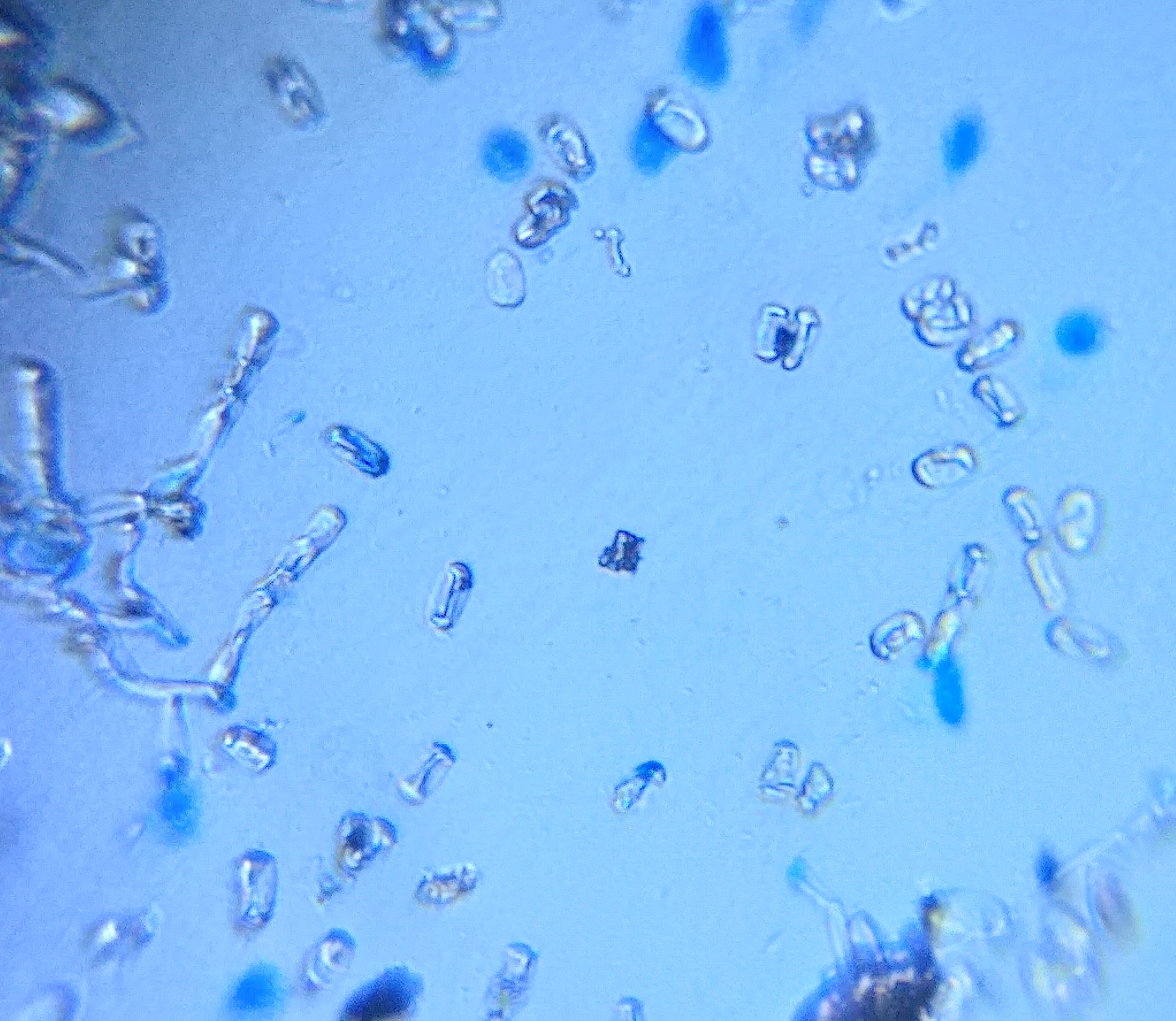 The ectophytic fungus- Erysiphe polygoni causing powdery mildew ...