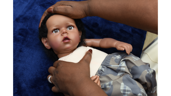 Infant Head Tilt Physical Therapy, Exercises Explained In New Book For ...